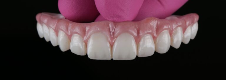 MOD Design Services - Advanced dental design services from a clinician ...